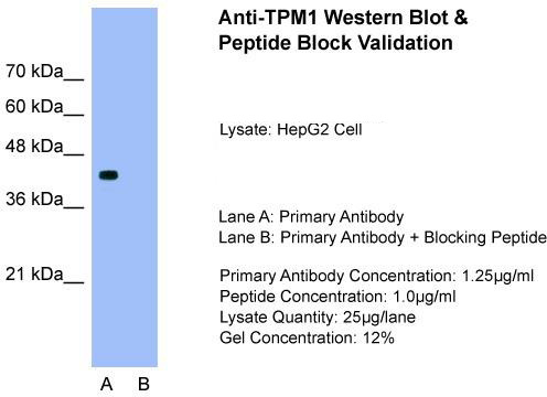 TPM1 Rabbit Polyclonal Antibody – TA346033 | OriGene